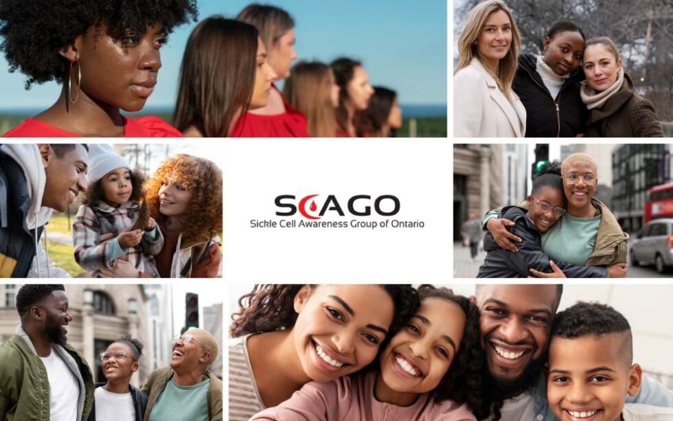 Spotlight on Sickle Cell Disease - Federated Health Charities